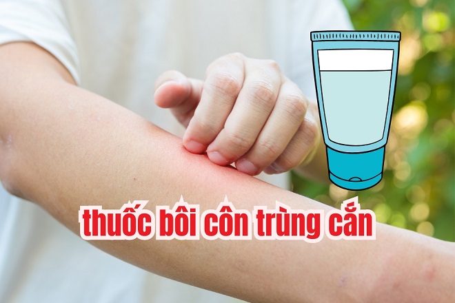 Top 11 thuốc bôi côn trùng cắn hiệu quả tốt nhất hiện nay